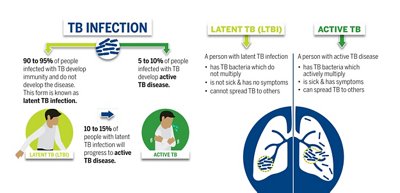 Tuberculosis | Pioneering Diagnostics